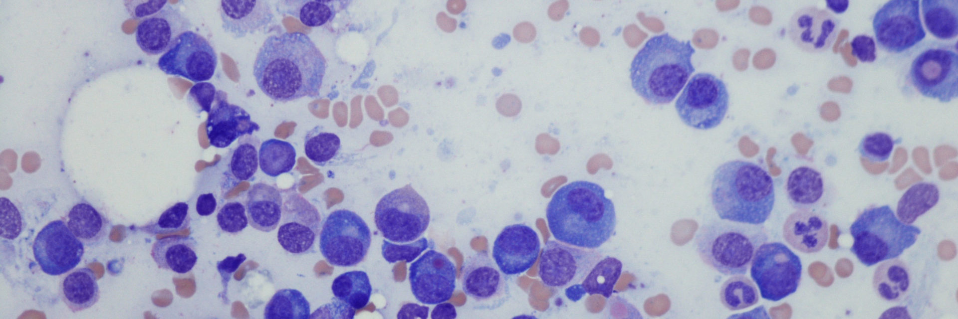 Understanding Cancer | Cancer Council NSW