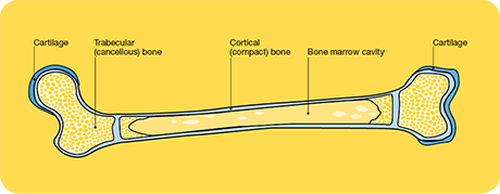 Primary Bone Cancer | Bone Sarcoma | Cancer Council NSW