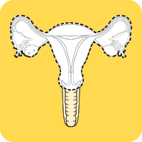 Surgery for Ovarian Cancer Treatment | Cancer Council NSW