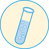 Stem Cell Transplants for Acute Myeloid Leukaemia (AML) | Cancer ...
