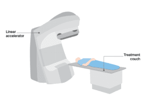 External beam radiation therapy (EBRT) | Cancer Council NSW
