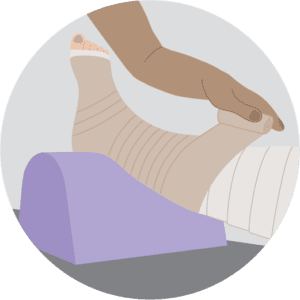 Treatment & Management of Lymphoedema | Cancer Council NSW