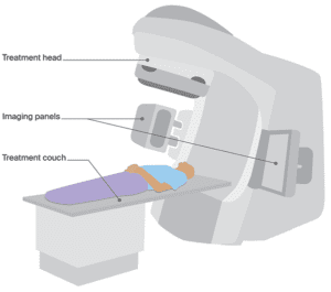 Radiation therapy for Lung Cancer | Cancer Council NSW