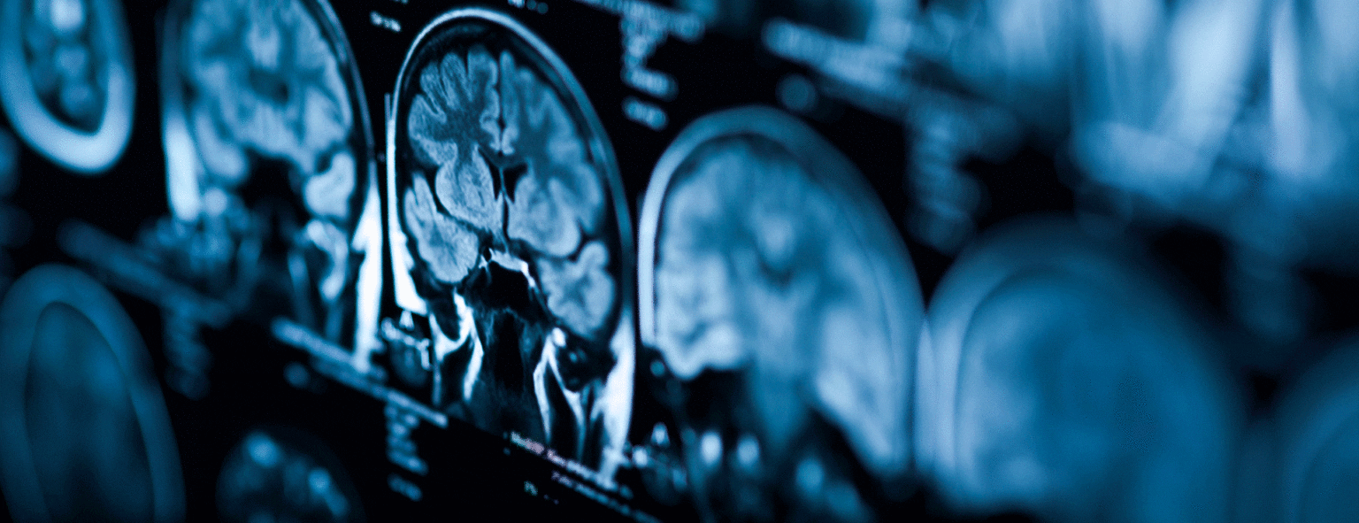 10 common tests and scans used to diagnose cancer | Cancer Council NSW